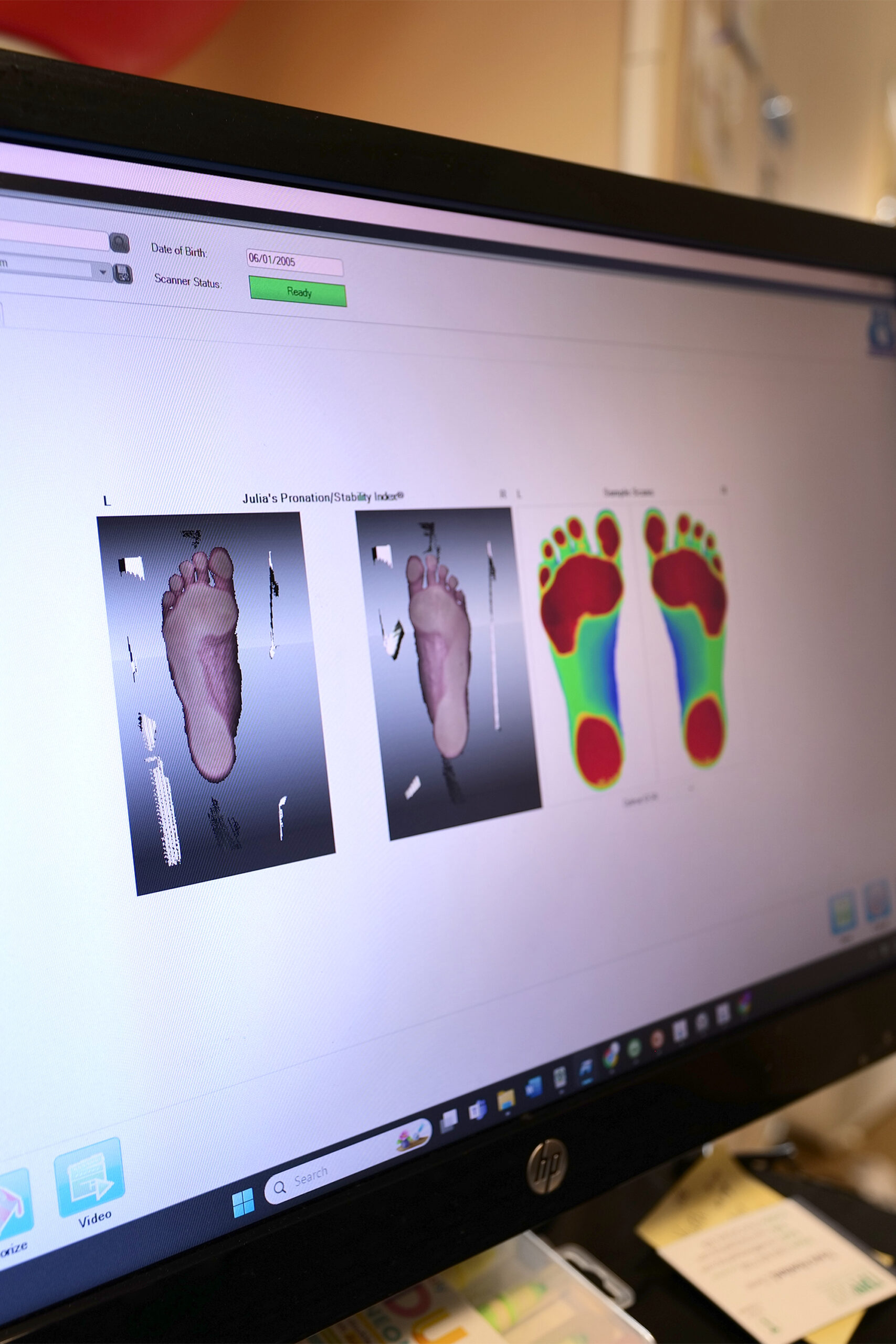 Foot Pain Chiropractor | Unison Chiropractic